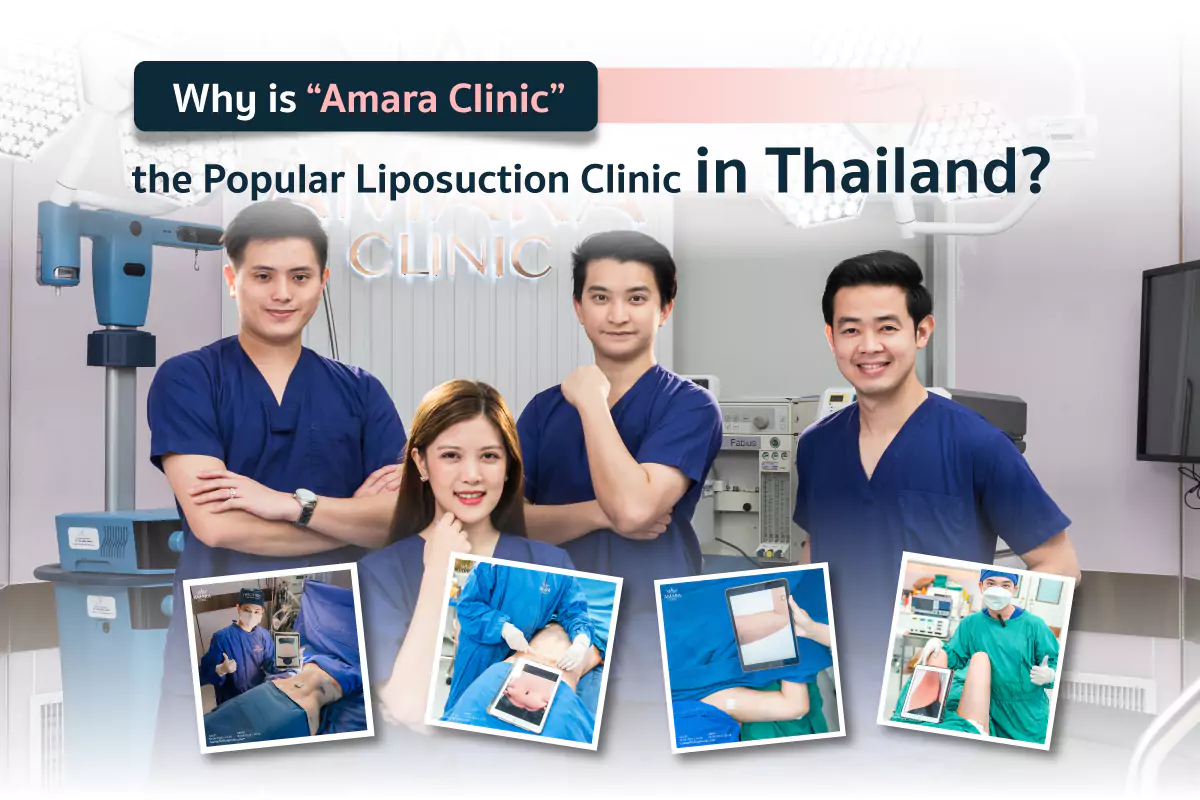 Amara Clinic Best Liposuction in Thailand: Liposuction Guide
